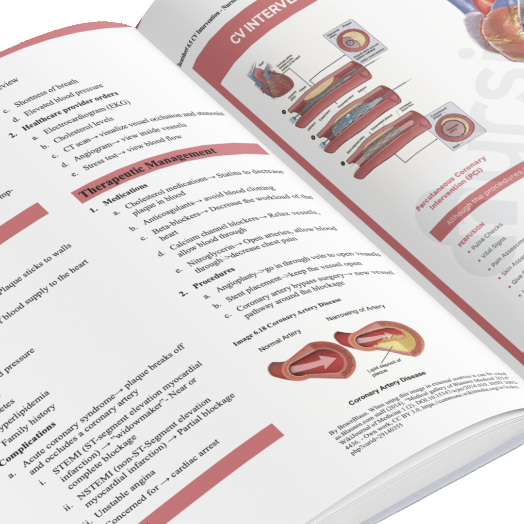 NCLEX Flash Notes: 77 Essential Nursing Topics for NCLEX Success (Conc ...